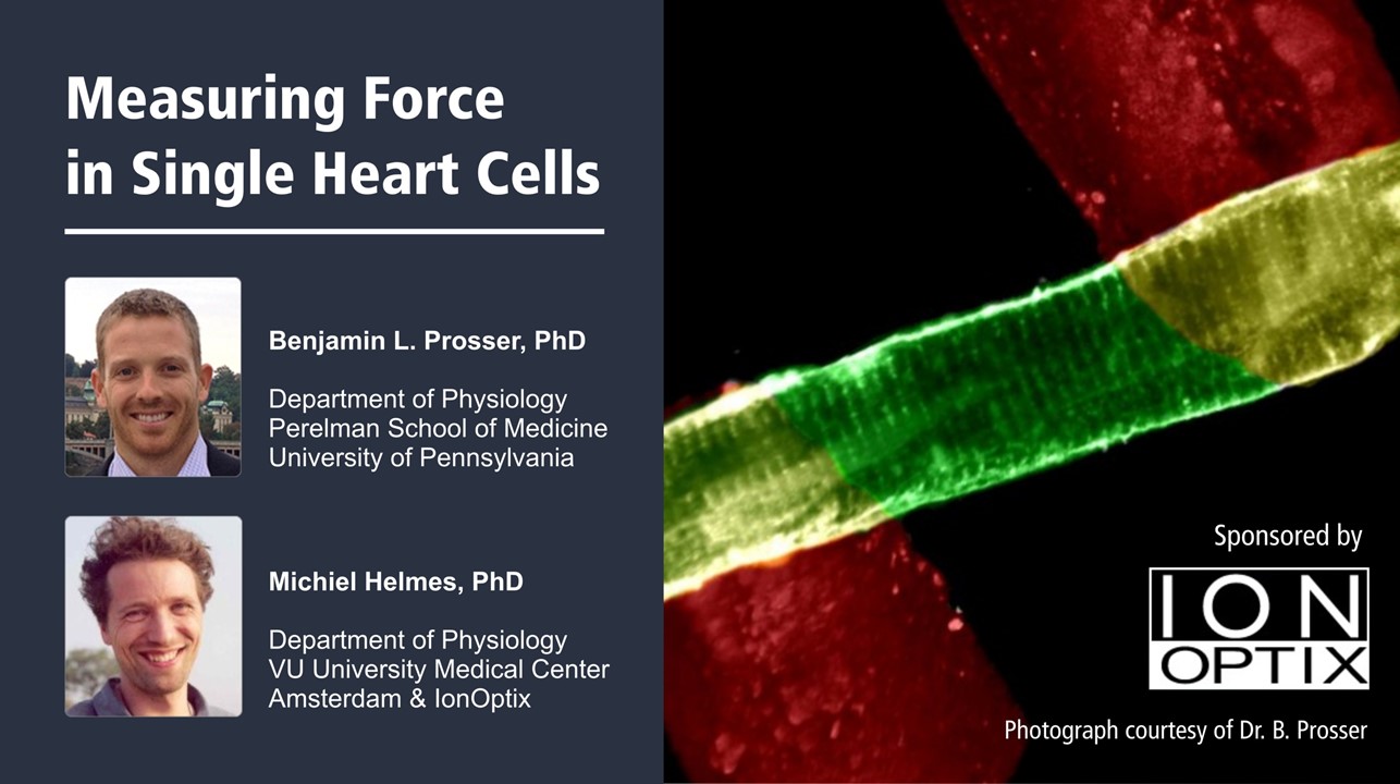 Measuring Force in Single Heart Cells - IonOptix