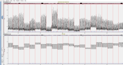 MultiAcq Calcium & Contractility Acquisition Module - IonOptix